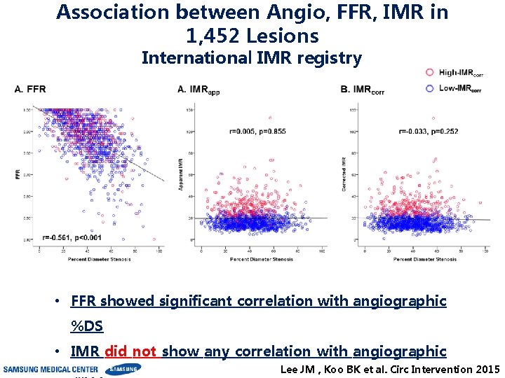 Coronary Microvascular Disease MVD and Clinical Prognosis in