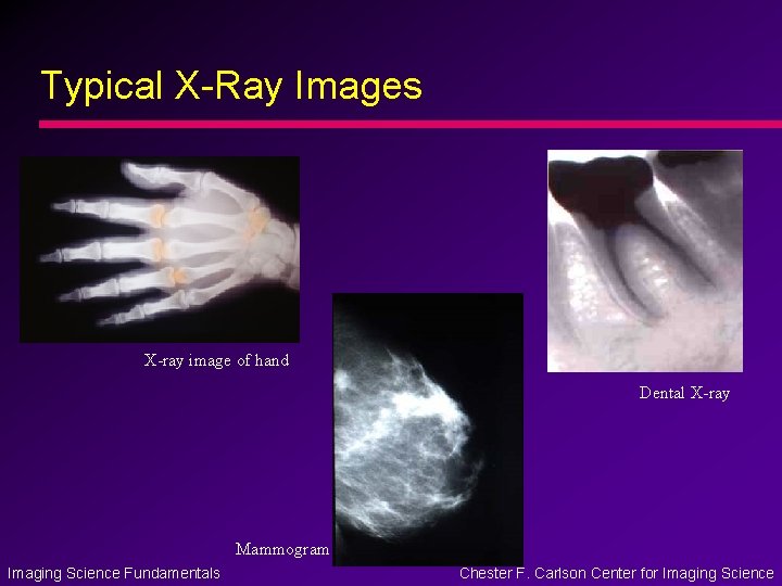 Medical Xray Imaging System Imaging Science Fundamentals Chester