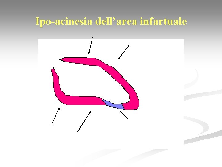 Irrorazione sanguigna del cuore La muscolatura cardiaca molto
