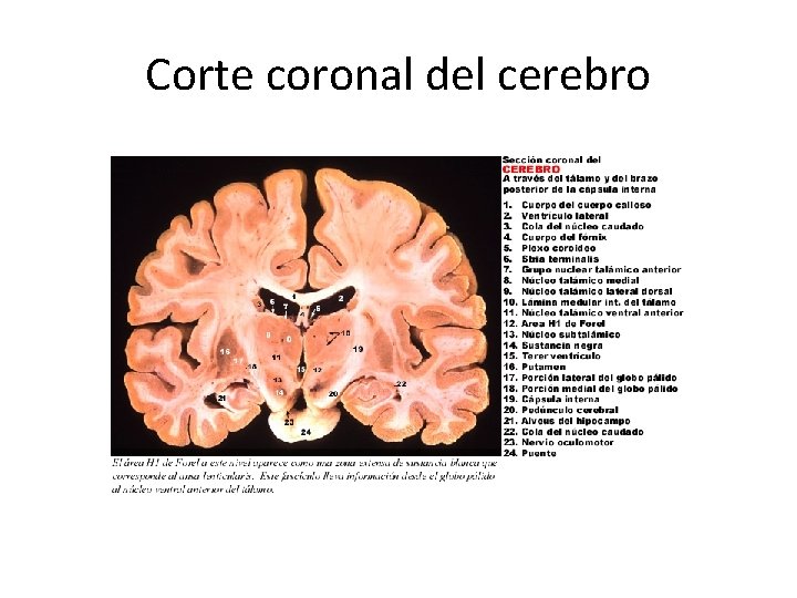 Neuroanatoma Ubicacin del cerebro Ubicacin del cerebro Cisura