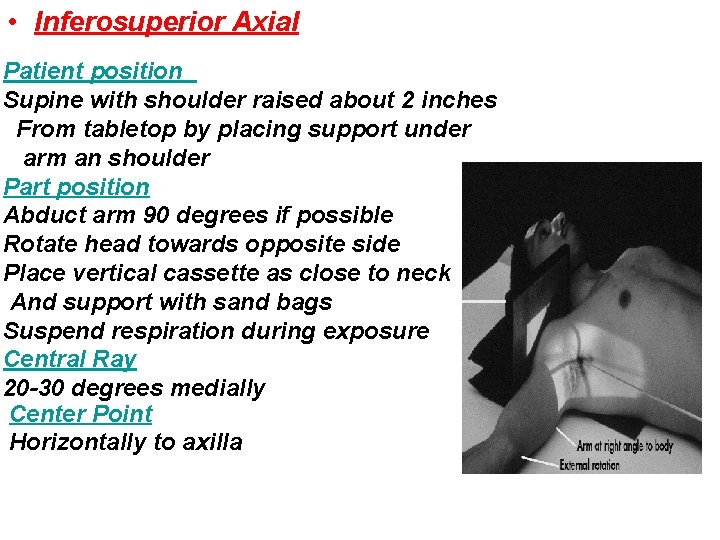 Lecture 10 Radiography of the shoulder Girdle Shoulder