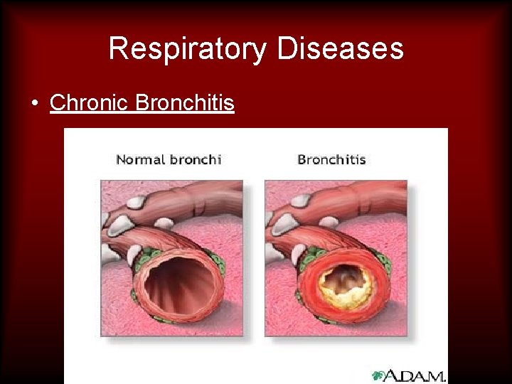 The Respiratory System What is Respiration Respiration is