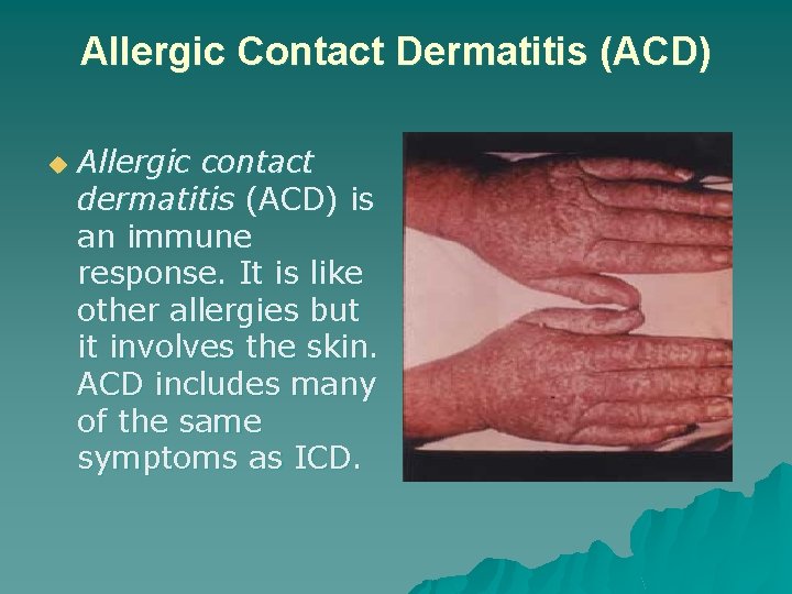 Working Around Concrete Safety 101 By Pat Gazewood