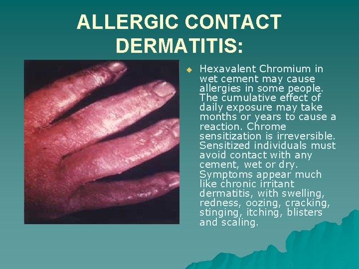 Working Around Concrete Safety 101 By Pat Gazewood