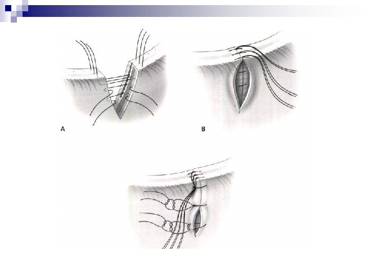 Eyelid Trauma AR Zandi MD Farabi eye hospital