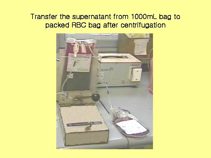 Methods of RBC Cryopreservation Consideration Highconcentration ...