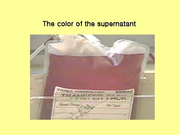 Methods of RBC Cryopreservation Consideration Highconcentration ...