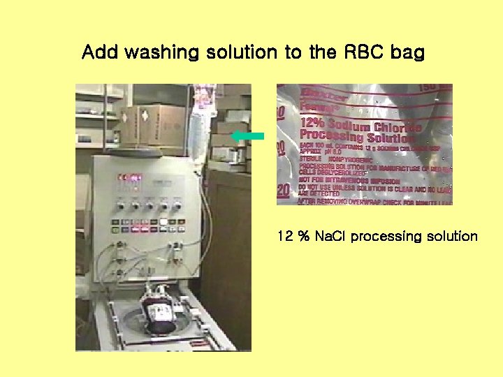 Methods of RBC Cryopreservation Consideration Highconcentration ...