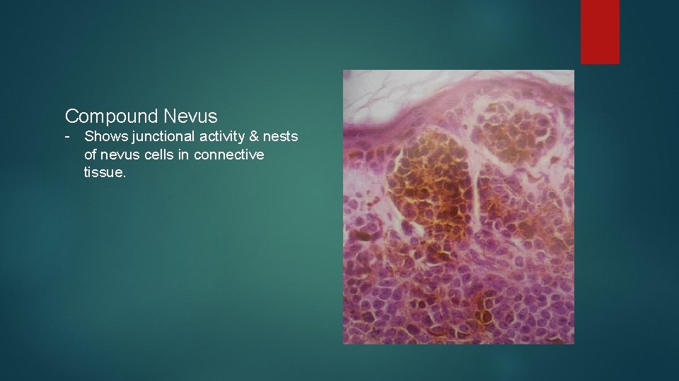 Disorders of Melanocytes Melanoma DR AMIT GUPTA ASSOCIATE