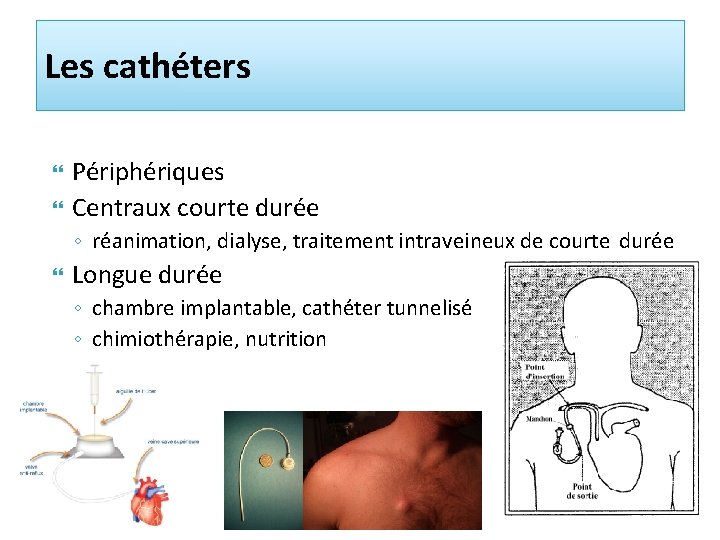 1712019 Infections sur cathter Dr S Alfandari Infectiologue
