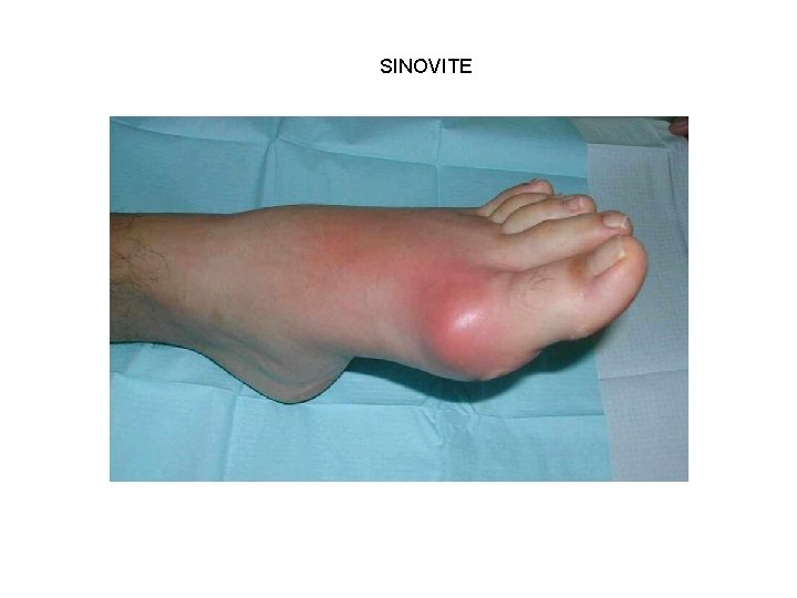 Sistema locomotor Com excepo das patologias de origem