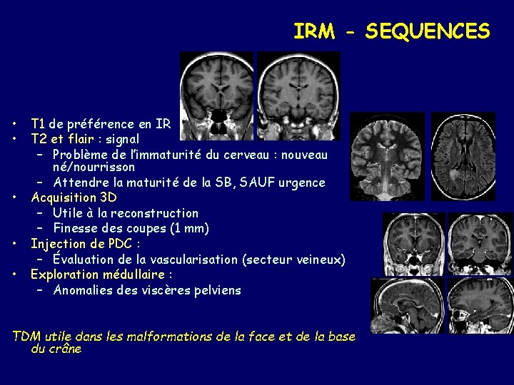MALFORMATIONS CEREBRALES Dr TLILIGRAIESS K Master Neuroradiologie Sousse
