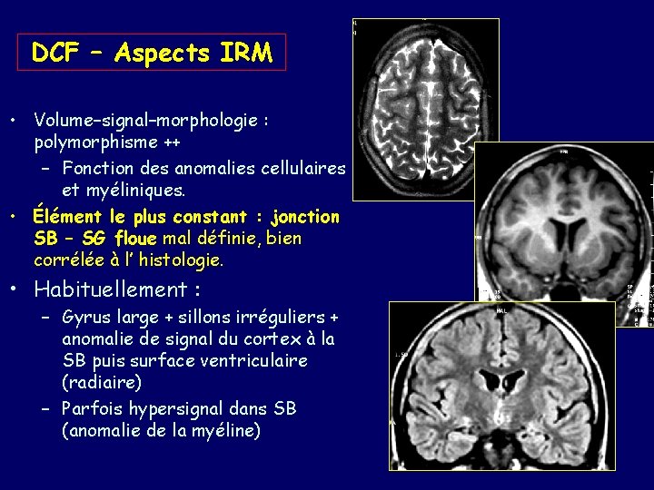 MALFORMATIONS CEREBRALES Dr TLILIGRAIESS K Master Neuroradiologie Sousse