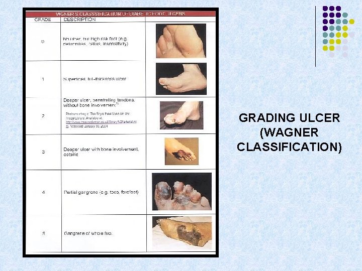 DIABETIC FOOT CARE BAGIAN ILMU KEDOKTERAN FISIK DAN