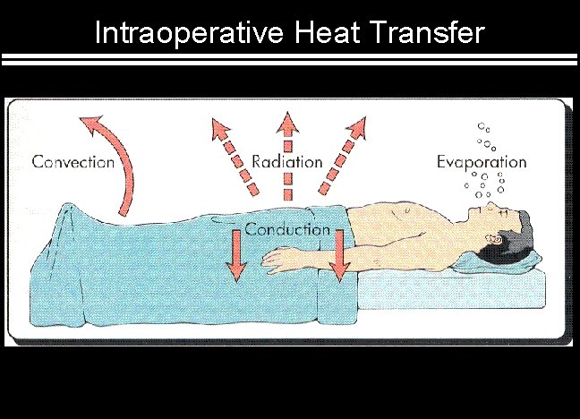 Department of OUTCOMES RESEARCH Thermoregulation Heat Balance ...