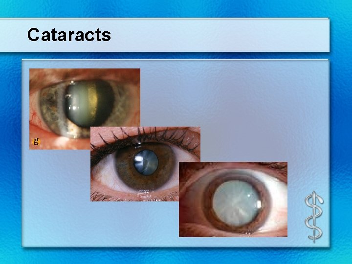 Common Ophthalmic Conditions in Primary Care Management of