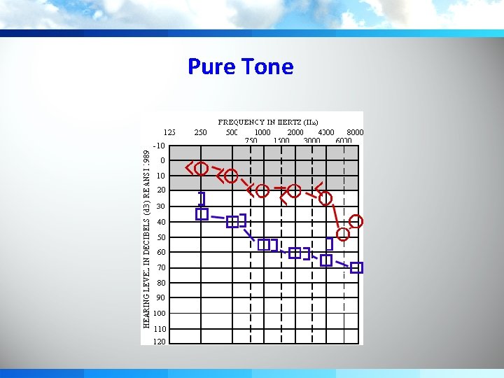 Acoustic Neuroma Department of Otorhinolaryngoglogy the 2 nd