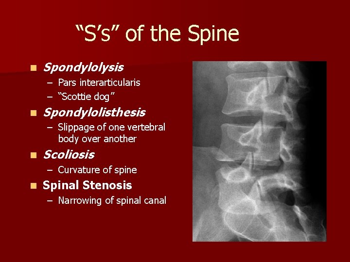 BACK EVALUATION Sara Brown D O Assistant Professor