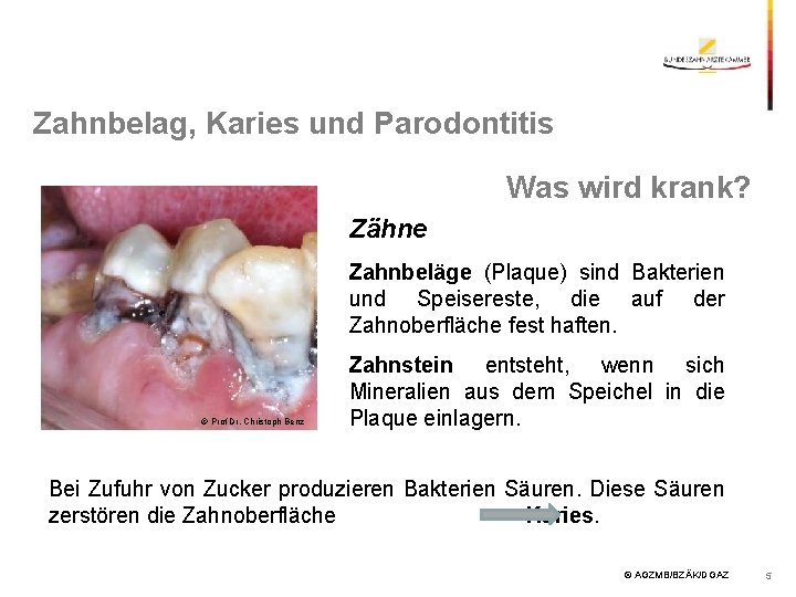 Zahn Mund und Zahnersatzpflege fr Menschen mit Pflege
