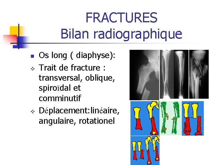 SEMIOLOGIE DES FRACTURES ENTORSES ET LUXATIONS SEMIOLOGIE ORTHOPEDIQUE