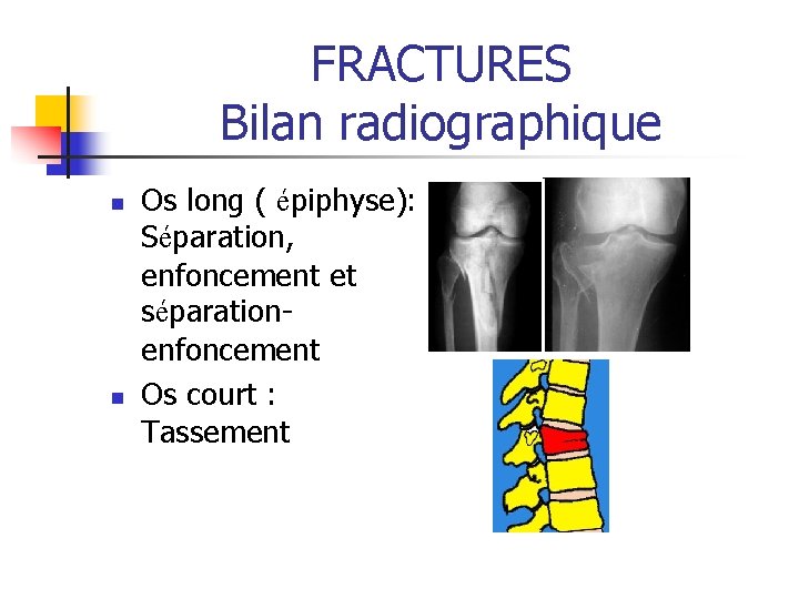 SEMIOLOGIE DES FRACTURES ENTORSES ET LUXATIONS SEMIOLOGIE ORTHOPEDIQUE