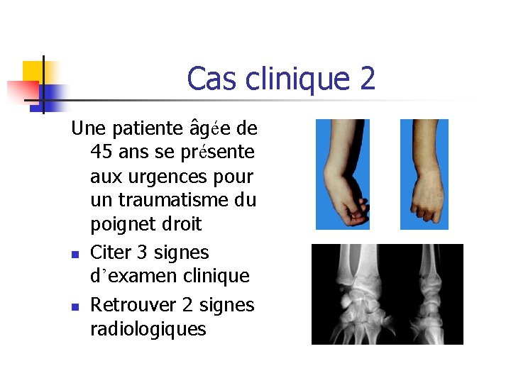 SEMIOLOGIE DES FRACTURES ENTORSES ET LUXATIONS SEMIOLOGIE ORTHOPEDIQUE