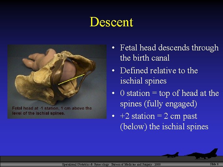 Labor and Delivery CAPT Mike Hughey MC USNR