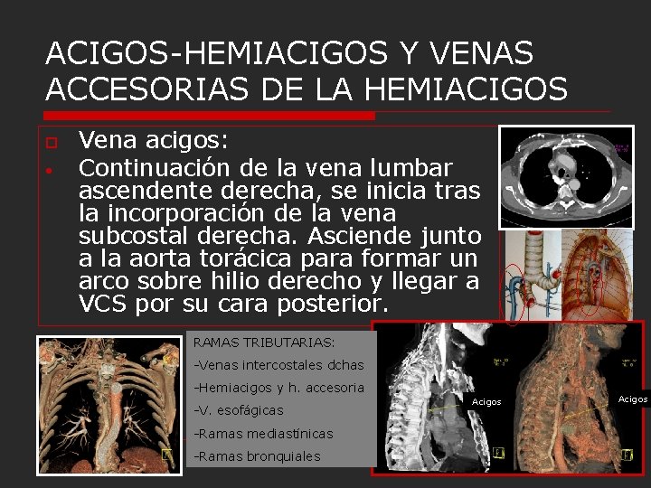 RED VENOSA COLATERAL PRINCIPALES SISTEMAS VENOSO o o