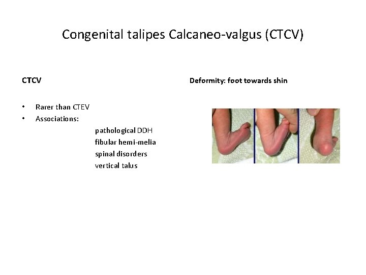 Childhood Orthopaedic conditions Dilemmas BOTA 2015 Robin W
