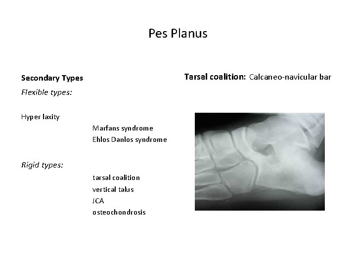 Childhood Orthopaedic conditions Dilemmas BOTA 2015 Robin W