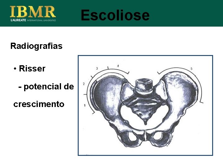 Disciplina de TraumatoOrtopedia e Reumatologia Patologias da coluna