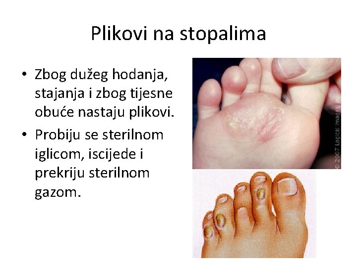 Zatita njega i bolesti organa potpore kretanja i