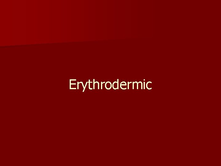 The Treatment And Management of Eczema Sharon Hulley