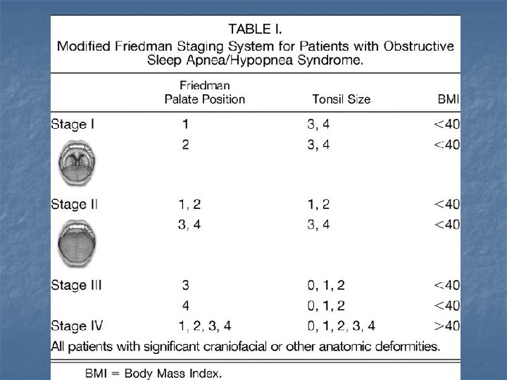 Surgical Management of Obstructive Sleep Apnea Marilene B