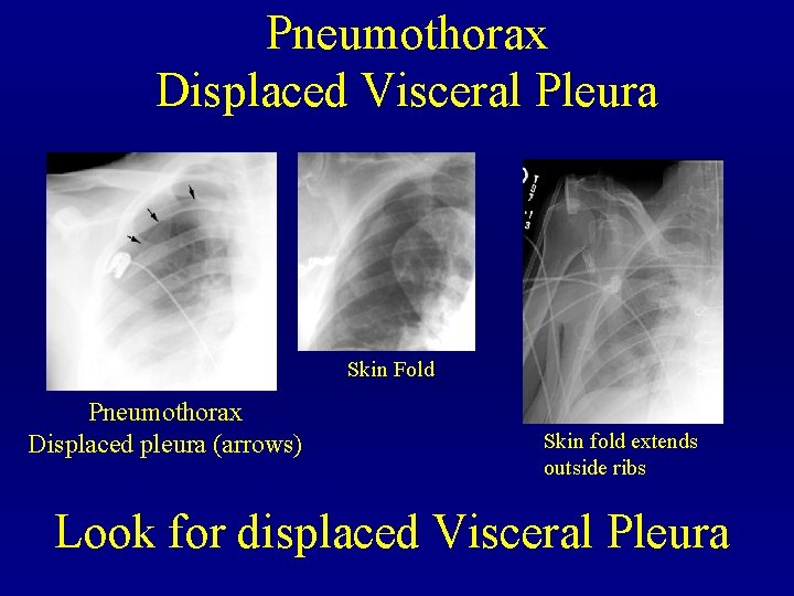 Chest Radiographs Loyola University Stritch School of Medicine