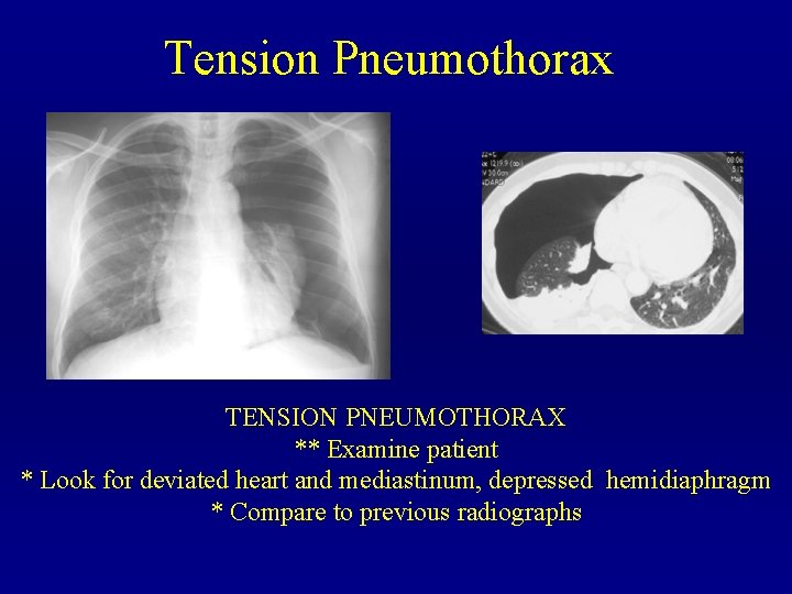 Chest Radiographs Loyola University Stritch School of Medicine