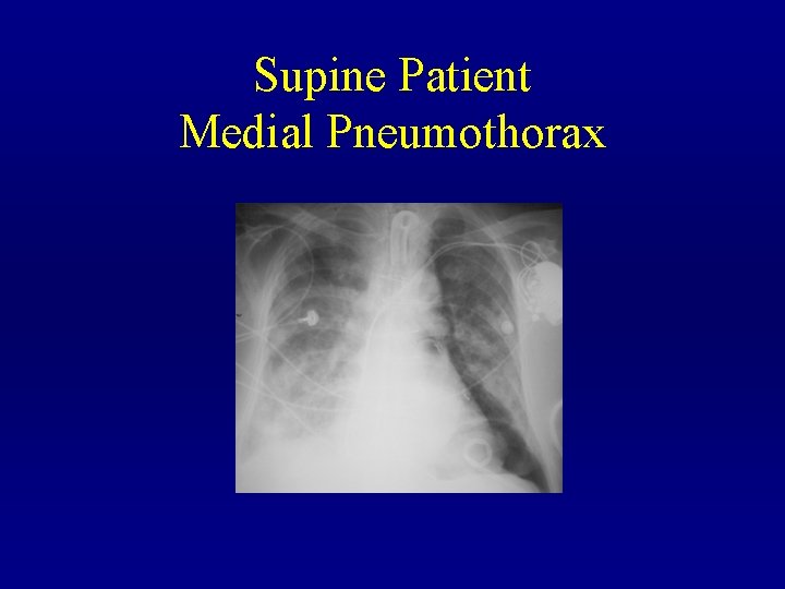 Chest Radiographs Loyola University Stritch School of Medicine