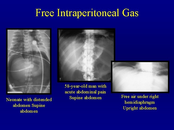 Chest Radiographs Loyola University Stritch School of Medicine