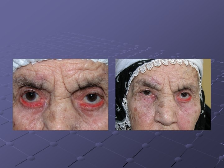 The Eye Lids Prof Dr Rengin Yldrm Normal