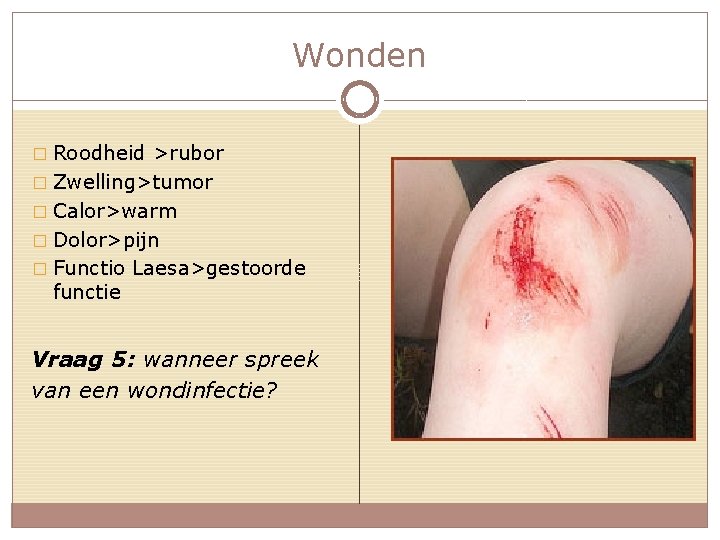 Wondverzorging Wondverzorging Doelen kennislijn Beschrijven van hoe een