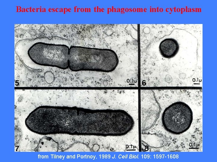 Corynebacterium Listeria Two aerobic Grampositive bacilli L monocytogenes