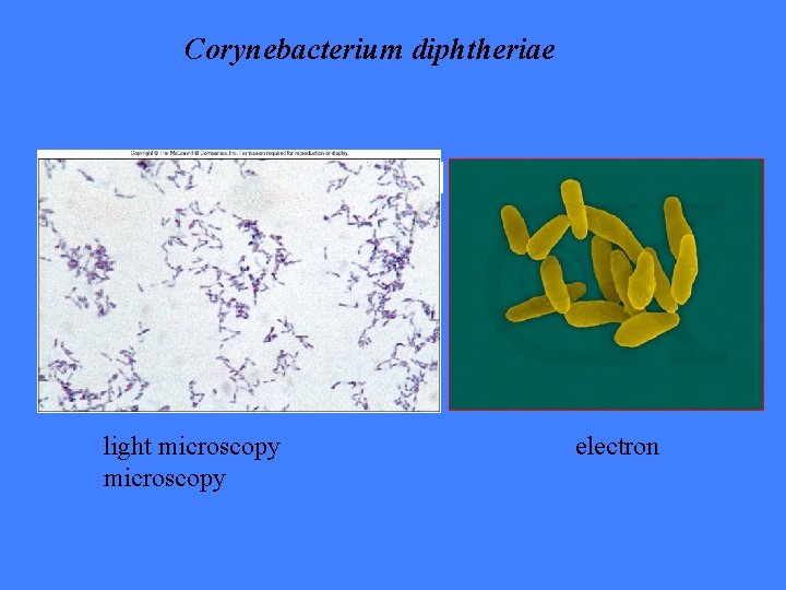 Corynebacterium Listeria Two aerobic Grampositive bacilli L monocytogenes