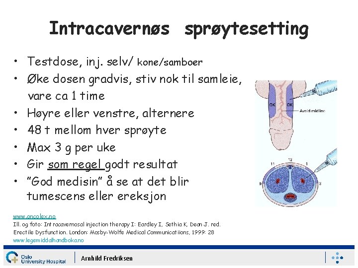 Ereksjonsfremmende behandling Hva kan uroterapeuten bidra med ED