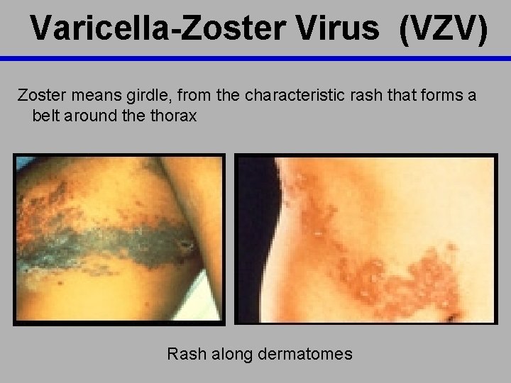 Med Chem 401 Herpesviridae Members of the herpesvirus