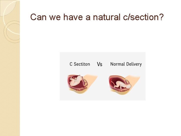 Normalising BirthJustifying Intervention What is Normal What does