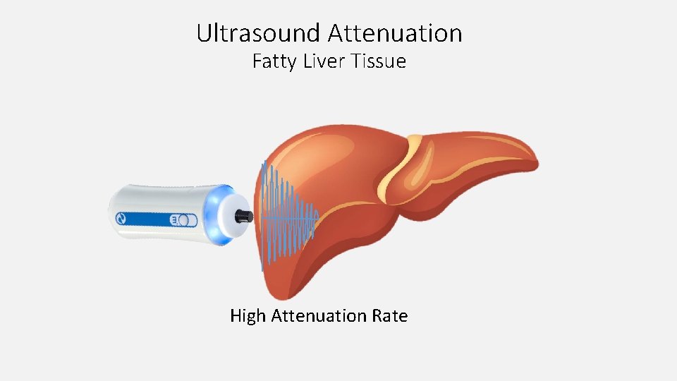 NonInvasive Liver Testing Noninvasive Liver Stiffness Testing Assessing
