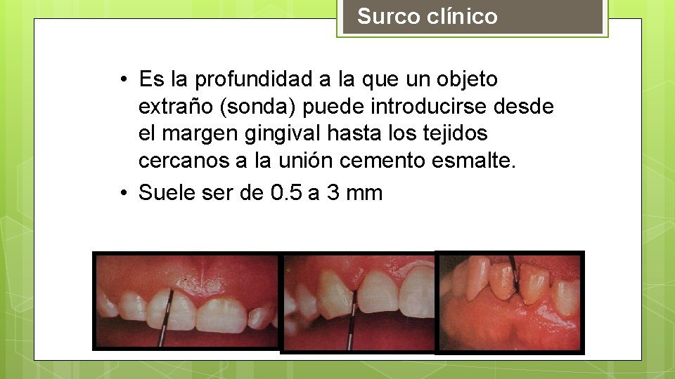 ANATOMIA DEL PERIODONTO Dra Karla Rpalo Objetivo de