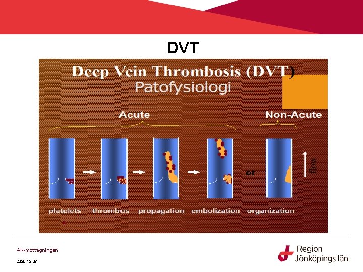 Antikoagulantia frdjupad introduktion Nyutbildade sjukskterskor 2017 05 09