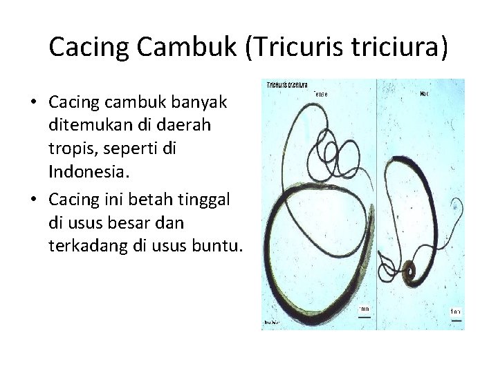 KECACINGAN Anda seperti ini Atau seperti ini Atau
