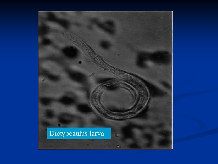 VERMINOUS PNEUMONIA VERMINOUS PNEUMONIA n Other names n